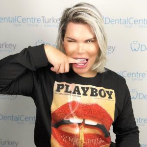 Rodrigo Jessica Alves: Biography Before and After Plastic Surgery, Wiki