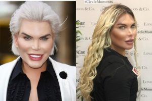 Rodrigo Jessica Alves: Biography Before and After Plastic Surgery, Wiki